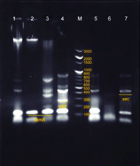 Detection Of S Aureus Enterotoxin Genes Set A Lane Mdna Ladder Download Scientific Diagram