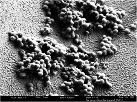 Scanning Electronic Microscope Image Of Staphylococcus Aureus Biofilm Download Scientific