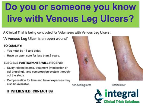 Venous Leg Ulcer Homestead Fl Metro Miami Clinical Trial 43409