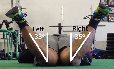 Identifying Hip Internal Rotation Range Of Motion MiguelAragoncillo Com