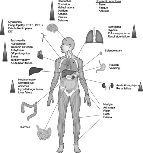 Cytokine Release Syndrome Journal For Immunotherapy Of Cancer