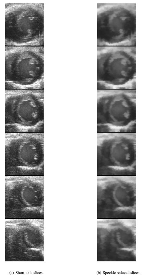 A The Original Short Axis Slices Acquired In Vivo B Speckle