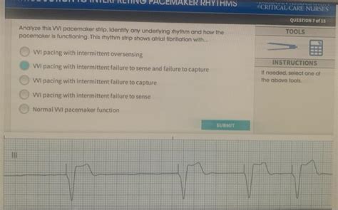 Solved Analyze This Wi Pacemaker Strip Identify Any