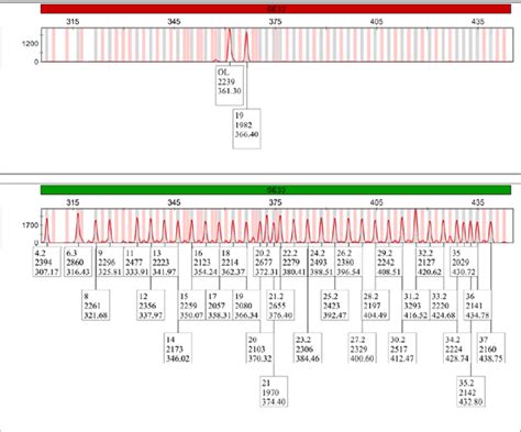 Solved Using The Following Electropherogram Determine The