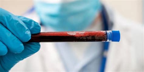 Hematokrit Penyebab Gejala Dan Cara Mencegahnya