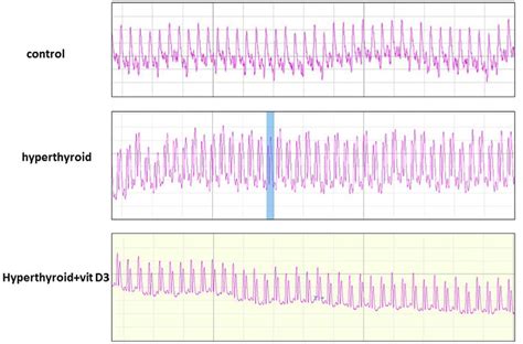Representative Ecg Traces Of The Studied Groups Download Scientific