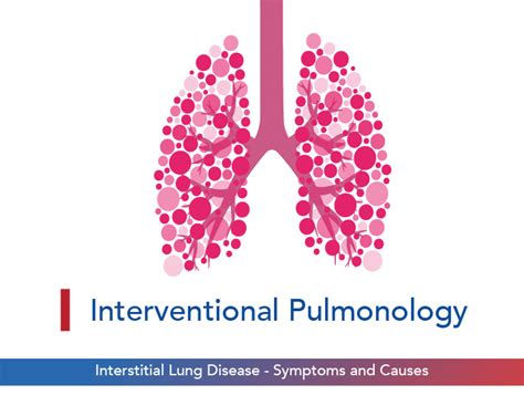 Interstitial Lung Disease Ild Symptoms Causes And Treatment