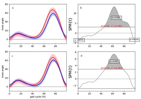 Sofigait—a Wireless Inertial Sensor Based Gait Sonification System
