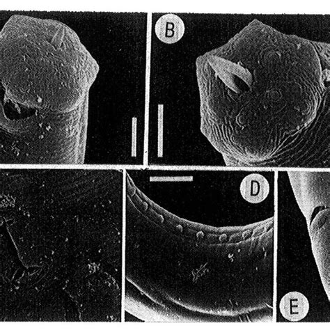 Mesodorylaimus Vulvastriatus N Sp Aentire Female Bentire Male