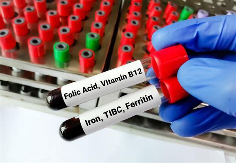 Premium Photo Iron Tibc Ferritin And Folic Acid Vitamin B12 Test To