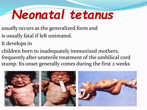 Tetanus Pptx