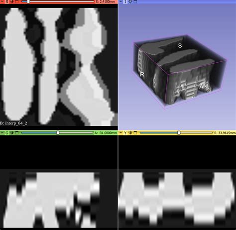 The Image Is Full Of Zero After Using Resample Filter Engineering Itk