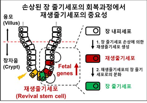 만성 장 질환 환자 희소식손상된 장 재생시키는 단백질 발견