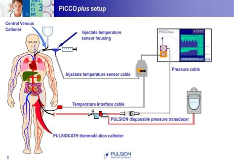 Ppt Picco Plus Powerpoint Presentation Id 3376003