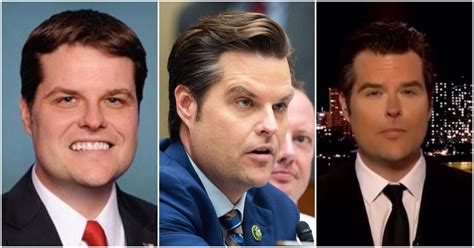 What Happened To Matt Gaetz S Face His Transformation Explored