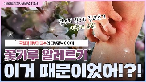 꽃가루 알레르기가 있는데 🥝과일을 조심해야 하는 이유🍍｜집먼지 진드기 알레르기가 있다면 이렇게 👩🏻‍⚕️ 언니네피부과 Youtube