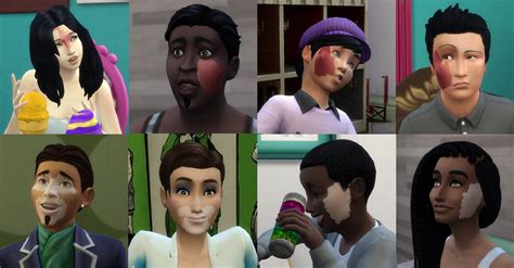 Sims 4 Vitiligo Skin Detail Sharpmaz