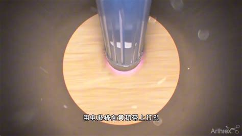 手术破坏大，椎间孔镜治疗关节突关节病变引起的腰疼，3d演示。。 小李肺刀 小李肺刀 哔哩哔哩视频