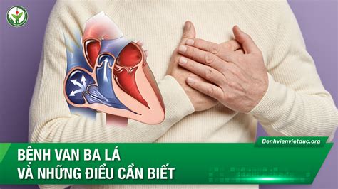 Bệnh Van Ba Lá Là Gì Nguyên Nhân Triệu Chứng Và Cách điều Trị