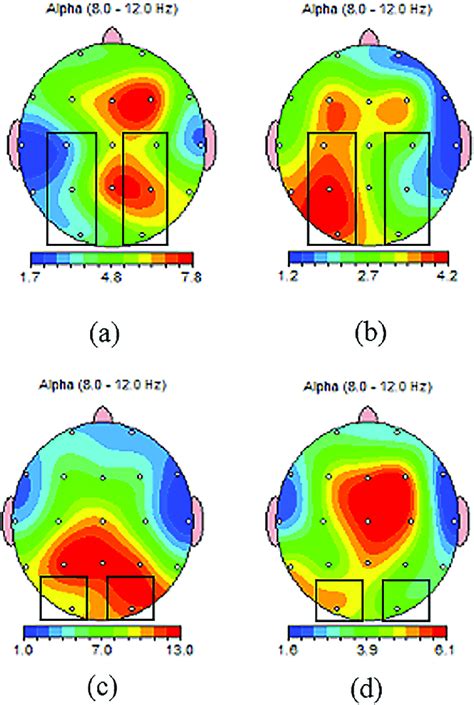 Example Brain Topographic Maps For The Visual Illusory Motion Stimulus
