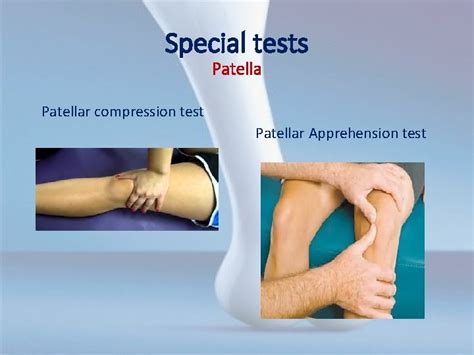 Floating Patella Syndrome At Brandon Premo Blog