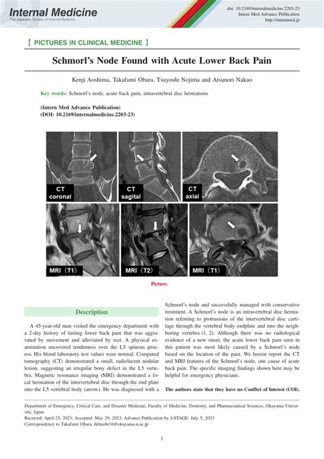 Pdf Schmorls Node Found With Acute Lower Back Pain