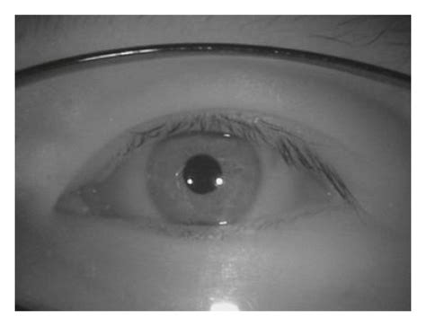 Iris Localization Result Without And With Reflective Noise Removal A Download Scientific