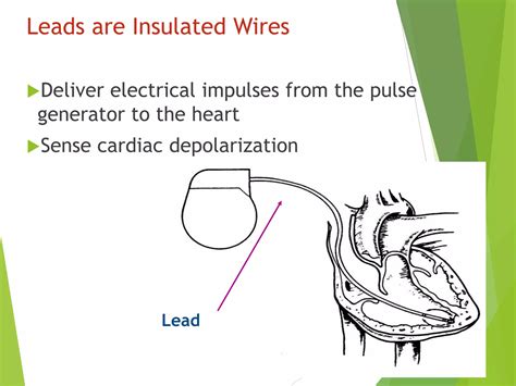 Pacemaker Basic And Timing Cycle Pptx