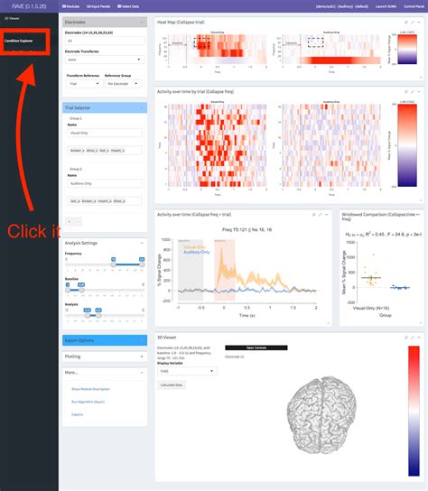 GitHub Beauchamplab Rave R Analysis And Visualization Of ECOG Data
