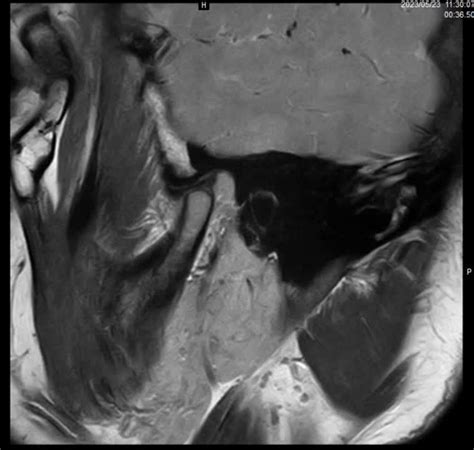 Joey Yap Sf On Linkedin Fujifilmhealthcare