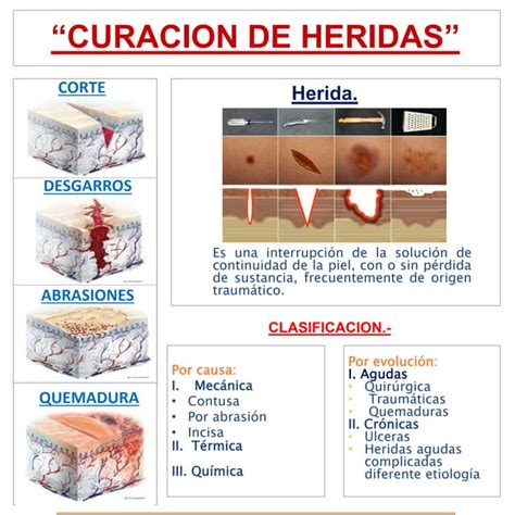 Infografia Curacion De Heridas Pptx