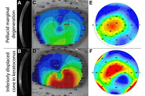 Unconventional Uses Of Optical Coherence Tomography Mivision