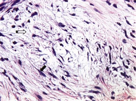 —high Power Of Figure 2 Note Fibroblast Like Cell With Elongated