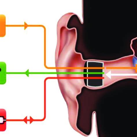 Tympanometry Normal Hearing At Vaughn Josephs Blog
