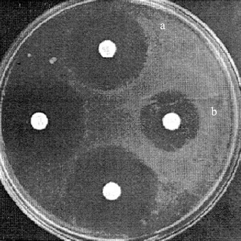 Extended Spectrum Beta Lactamase Producing E Coli Strain Confirmed Download Scientific