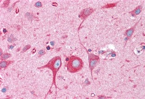 Anti Bcap31 Bap31 Antibody Arg63449 Arigo Biolaboratories