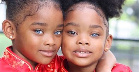 12 Years Later The Hidden Evolution Of Megan And Morgan The Twins Who