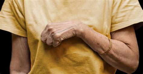 40 Facts About Volkmann Contracture