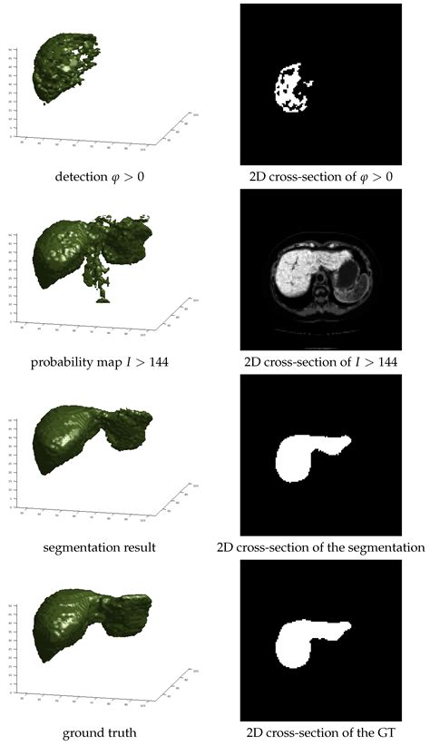 Electronics Free Full Text Fast 3D Liver Segmentation Using A