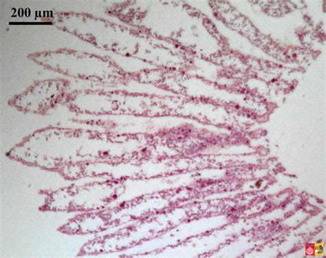 Cross Section Of Sycon
