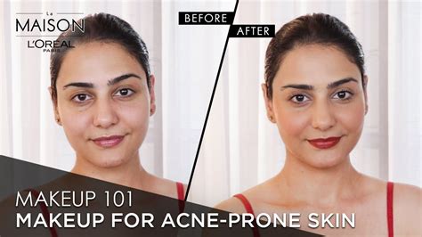 How To Hide Pimple Marks With Makeup In Hindi Saubhaya Makeup