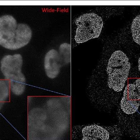 Denoising Super Resolution Images Using UNet Noisy Super Resolution