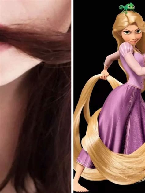 Rapunzel Syndrome Eating Hair Can Be Dangerous 13 साल की लड़की को है