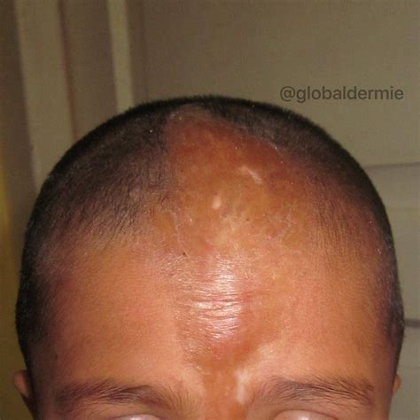 Morphèa Hashtag On Twitter