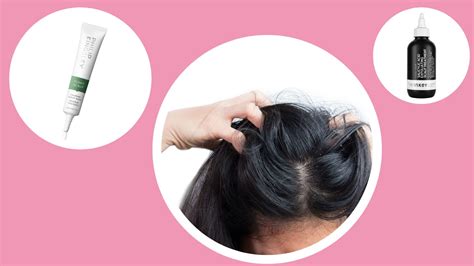 How To Get Rid Of Dandruff If You Re Struggling With Scalp Irritation