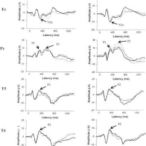Grand Average Waveforms Solid Thick Line For New Condition Broken