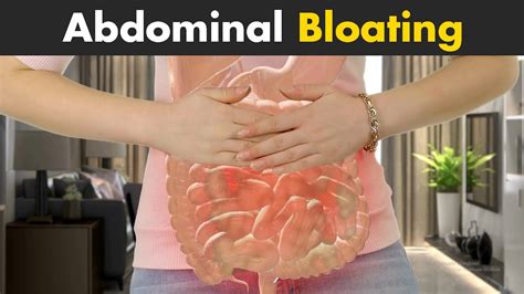 What Happens In Abdominal Bloating Symptoms Causes And Treatment Youtube