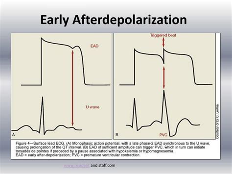 Ppt Long Qt Syndrome Powerpoint Presentation Id617836