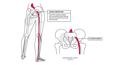 What Is The Sciatic Nerve Days To Fitness