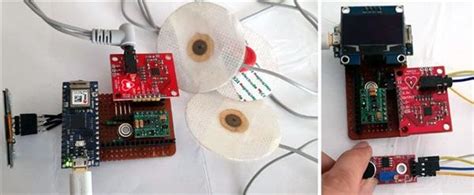 Iot Patient Monitoring System Share Project Pcbway